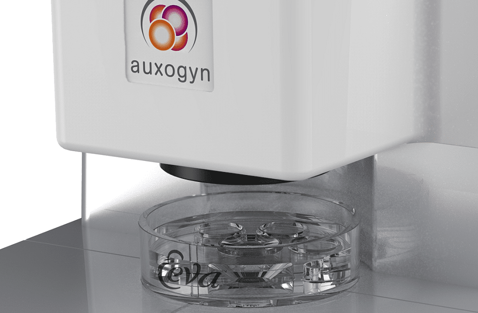 Le test EEVA (timelapse) pour une FIV