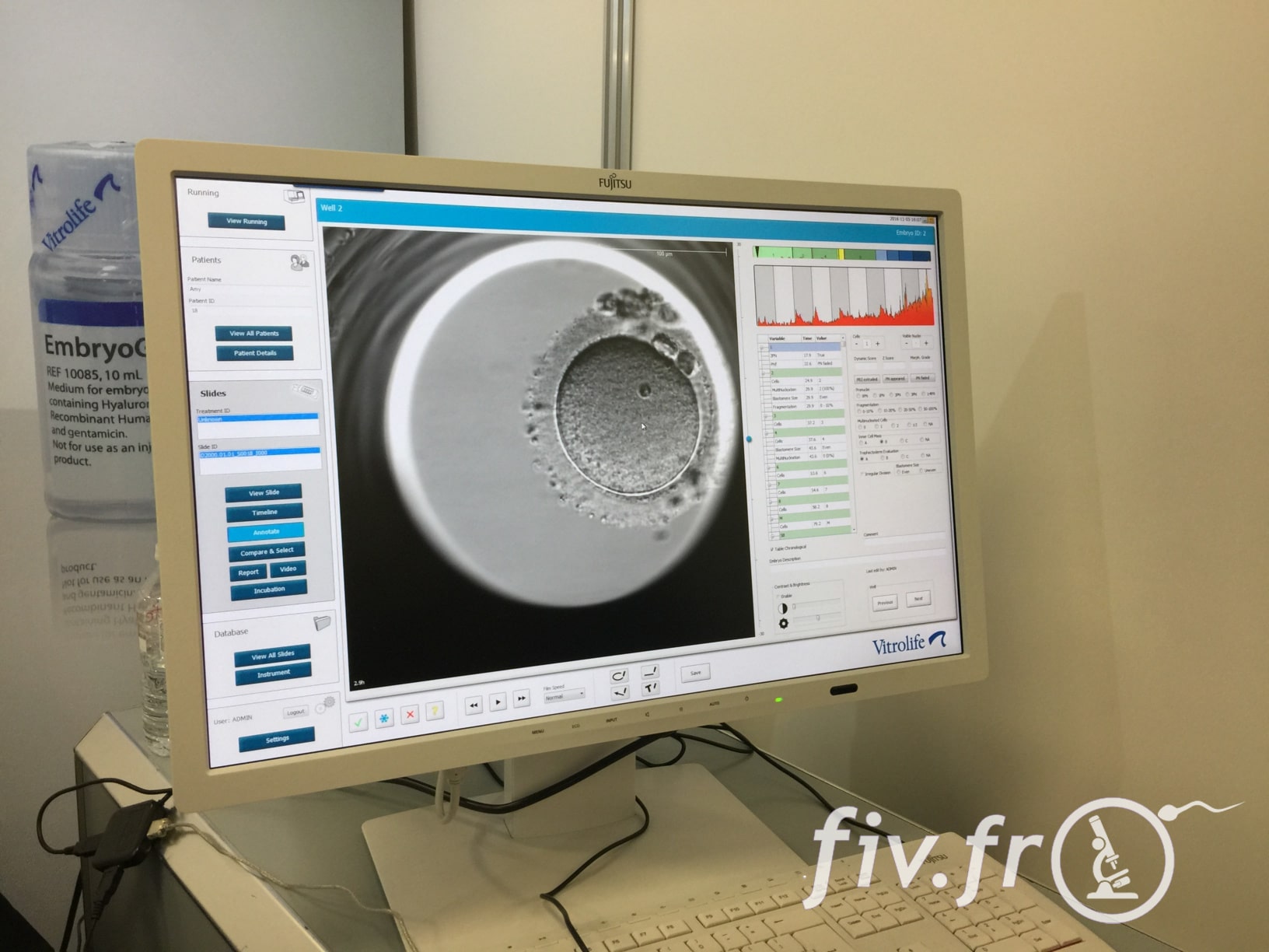 Embryoscope (timelapse) • Fiv.fr