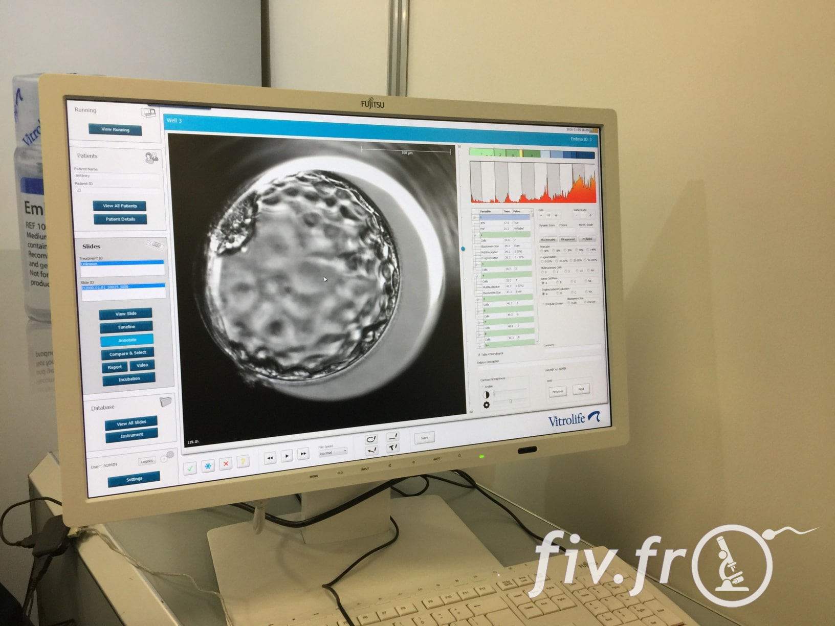 Embryoscope (timelapse) • Fiv.fr