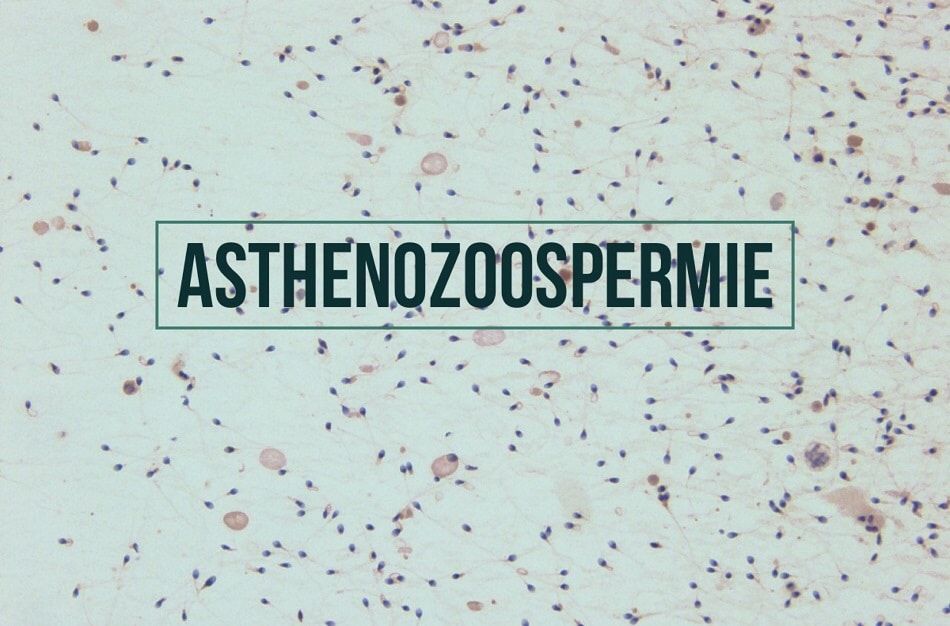 Asthénozoospermie (asthénospermie) • Fiv.fr